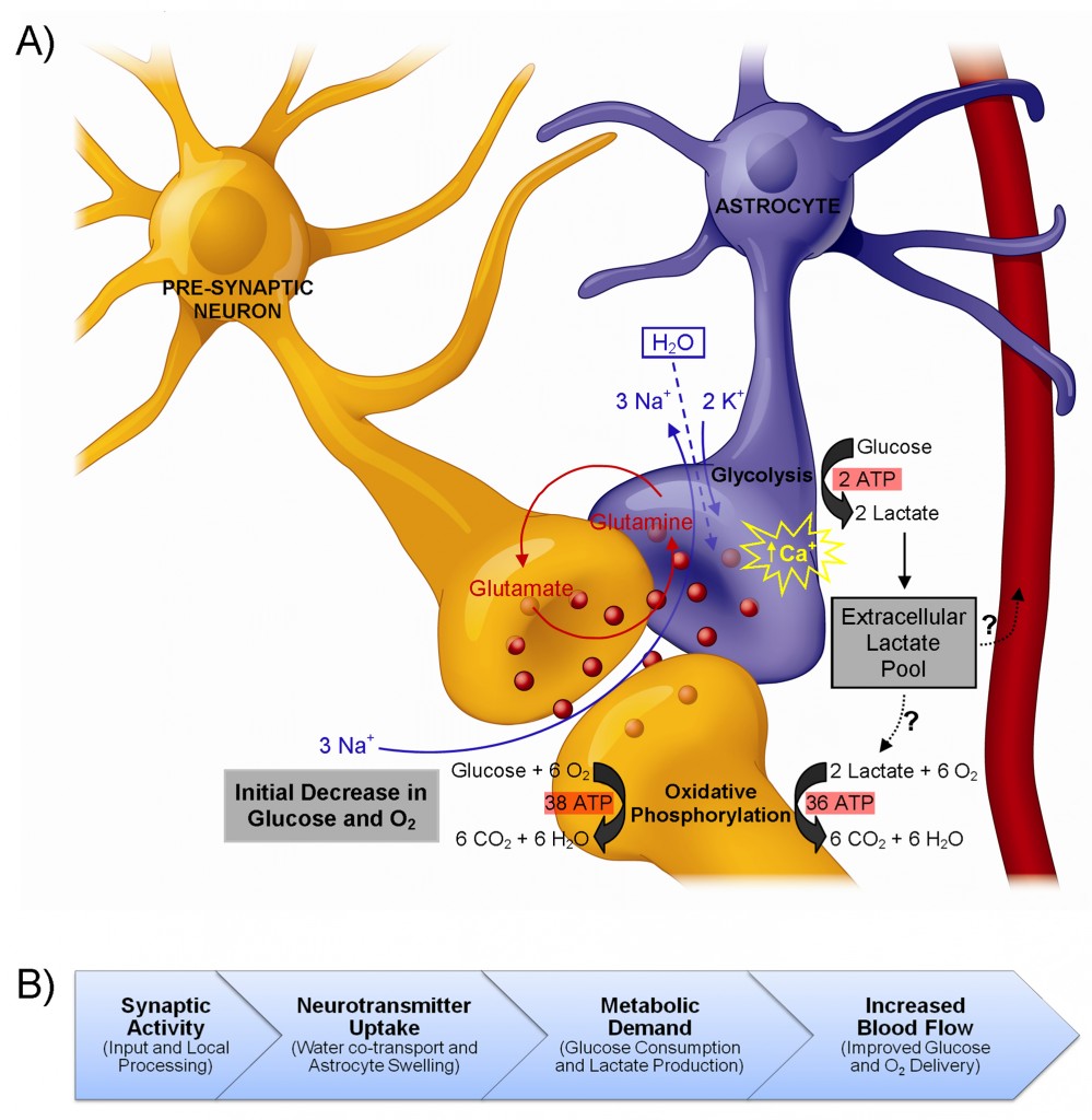 Figley NeuroImaging Lab » Research